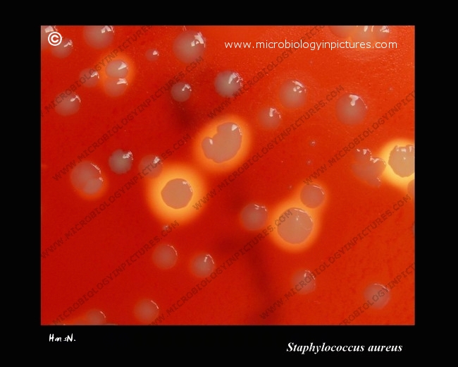 Beta Hemolysis Staphylococcus Aureus